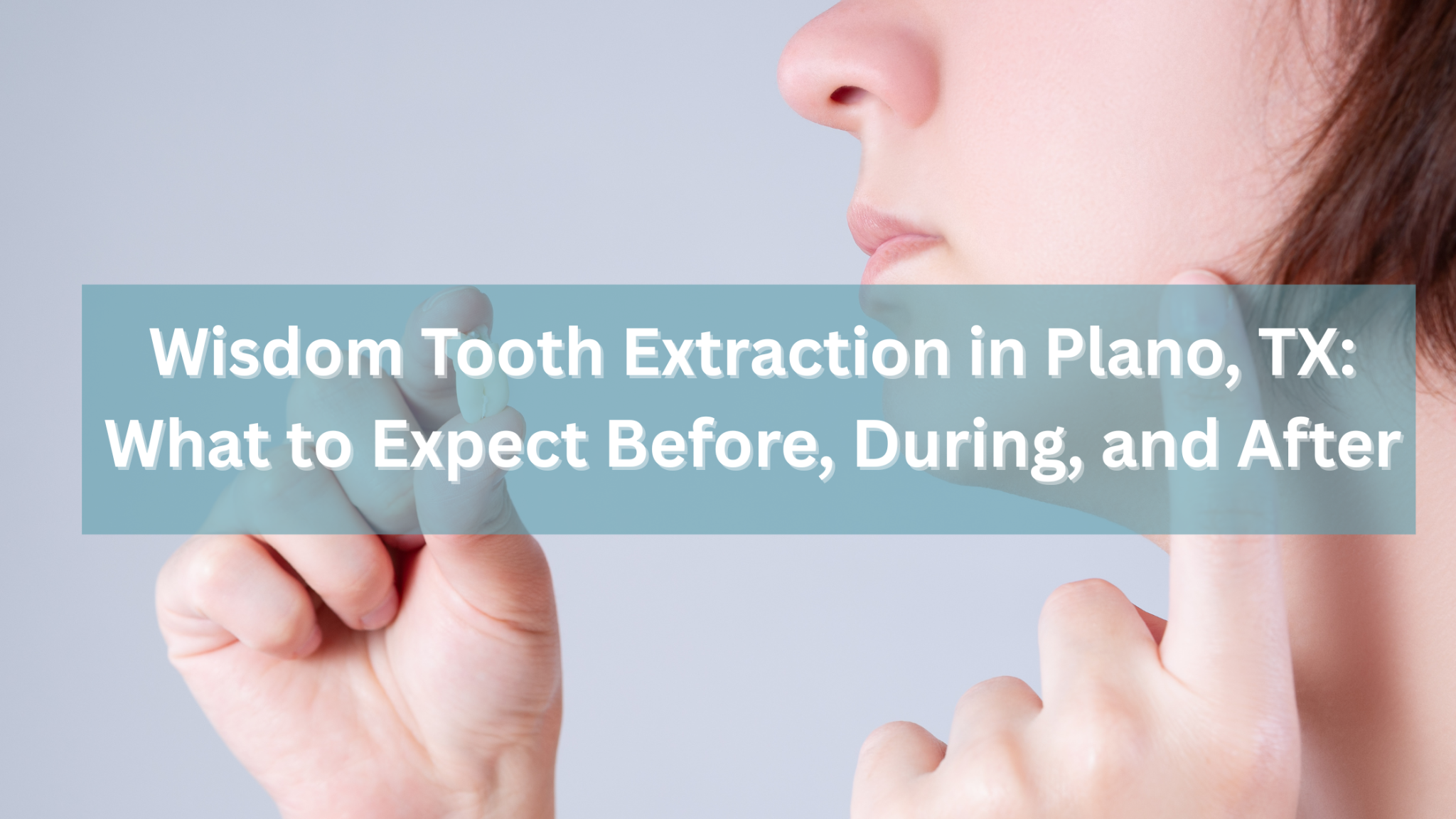 Wisdom Tooth Extraction in Plano, TX: What to Expect Before, During ...