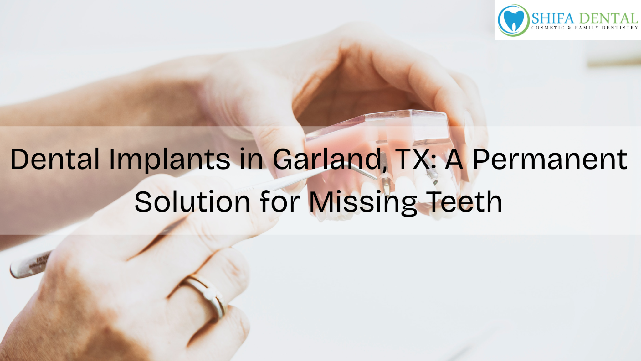 Dental Implants in Garland, TX: A Permanent Solution for Missing Teeth - Shifa Dental | Dental ...