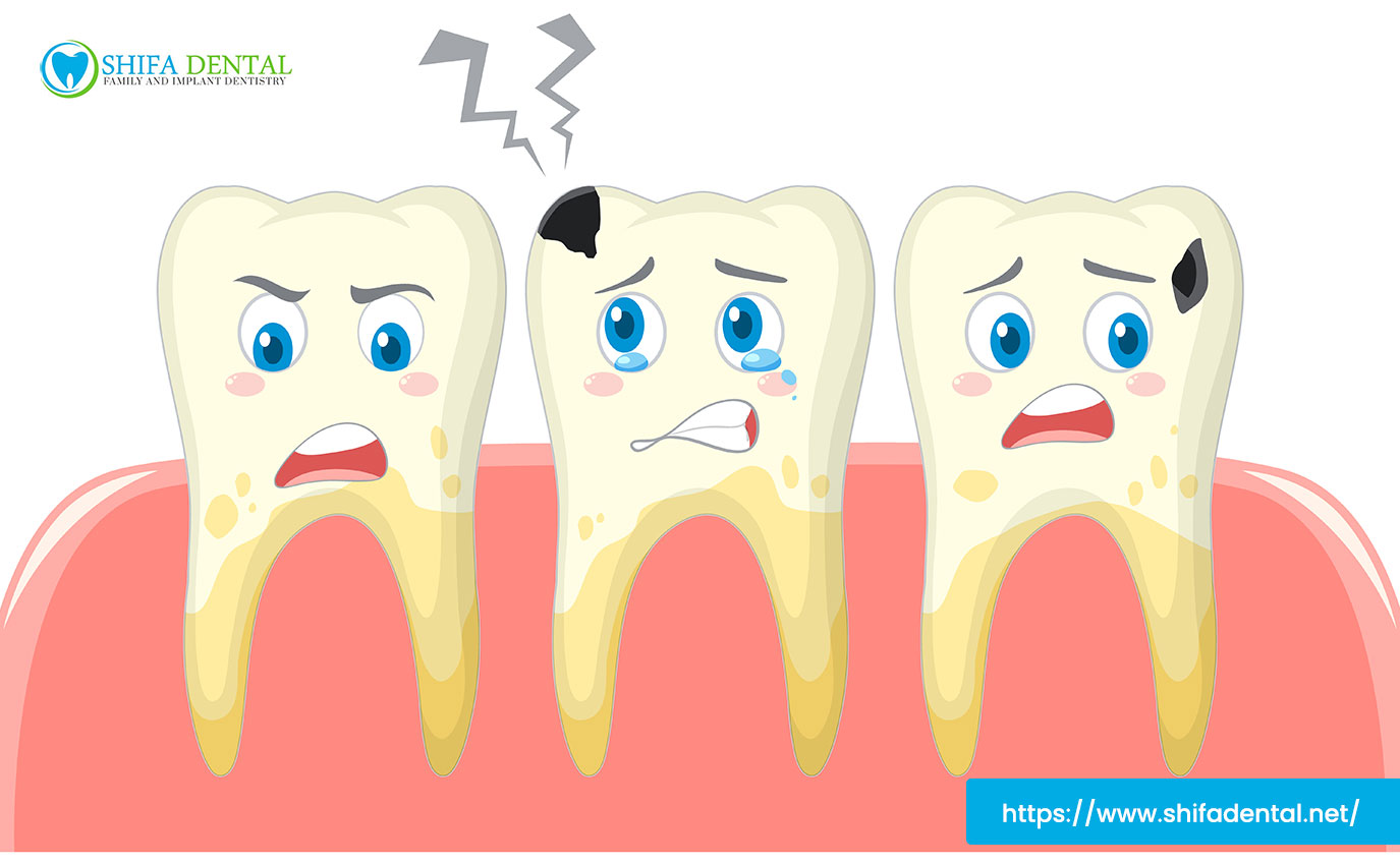 How to Fix Severely Damaged Teeth Before They Get Worse